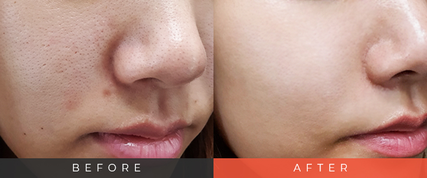 [부산점] 바노바기클리닉